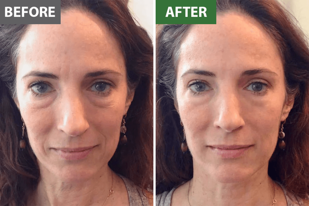 Special Offer - Hypha Skincare